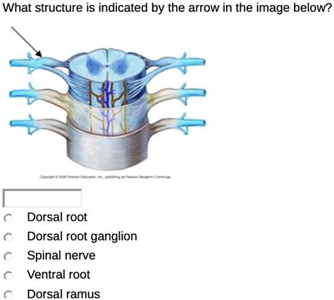 What Structure Is Indicated By The Arrow In The Image Below Dorsal