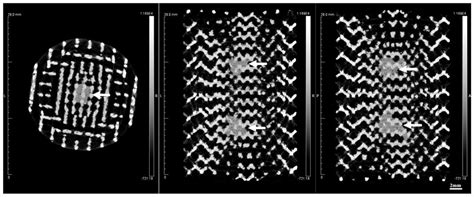 A Non Destructive Detection Method For Internal Defects Of Porous Materials Eureka Patsnap