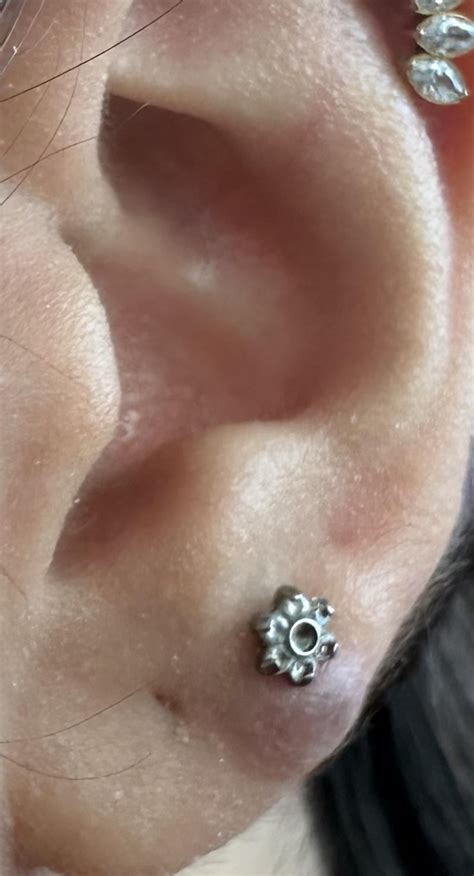 Help This Bump Suddenly Appeared And Has Been Growing Since Around 3