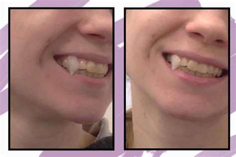 Tutorial How To Make Vampire Fangs For Cosplay Tutorial How To Make Vampire Fangs For Cosplay