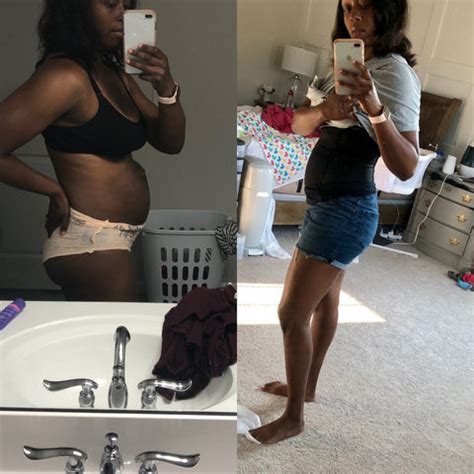 Before And After Pregnancy Body Photos Belly Bandit