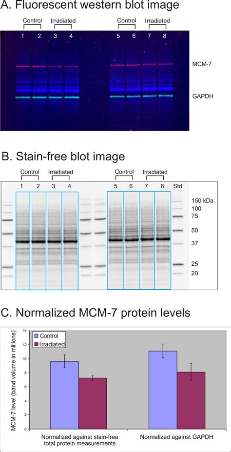 V3 Stain Free Workflow For A Practical Convenient And Reliable Total