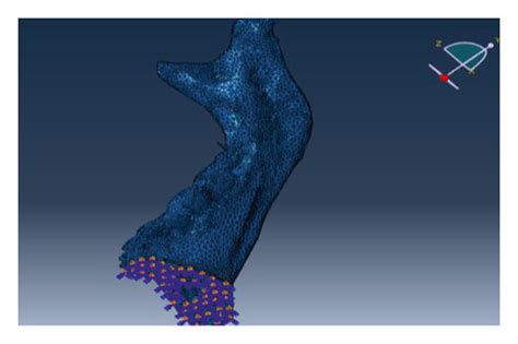 Boundary Conditions A Glenoid Fossa Component Fully Constrained At Download Scientific