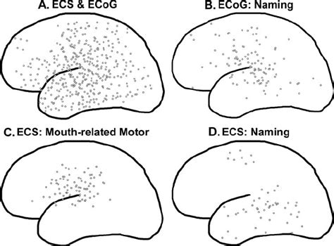 Spatial Distribution Of Ecog And Ecs Maps From All 13 Patients In Download Scientific Diagram
