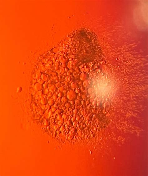 Amandeep Singh Bedi On Linkedin Thank You Dr Inder Singh For Sharing These Incredible Images