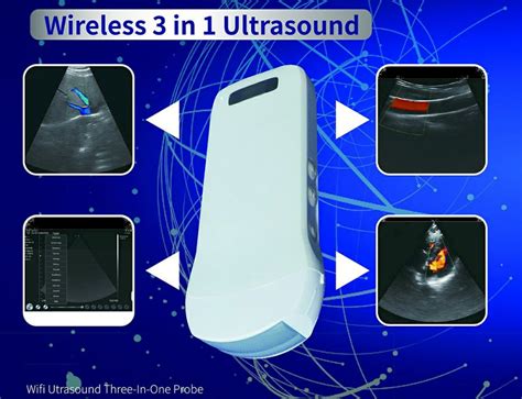 Wireless Convex Probe Tagged Phased Array Wifiultras Wireless Convex Probe Tagged Phased Array Wifiultras