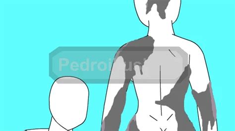 Deku Vs Uraraka Editable By Pedroillusions