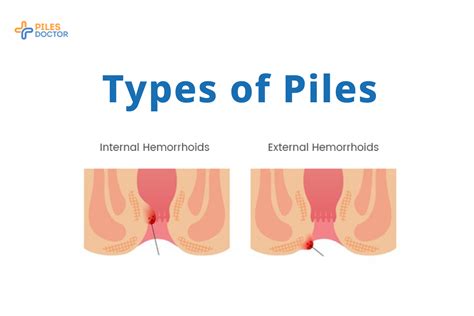 Human Piles Pictures