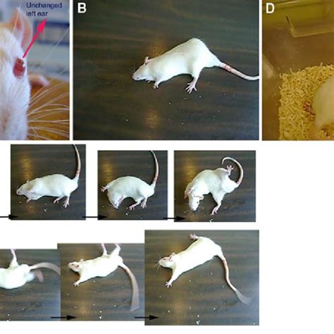A Ocular Skew Deviation After Right Labyrinthectomy B Right