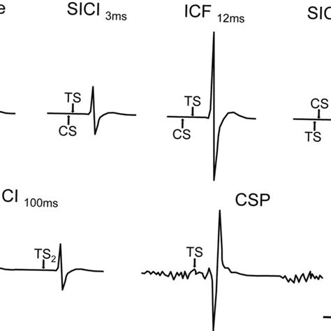 Typical EMG Responses To The TMS Stimulation Protocols For SICI ICF Download Scientific
