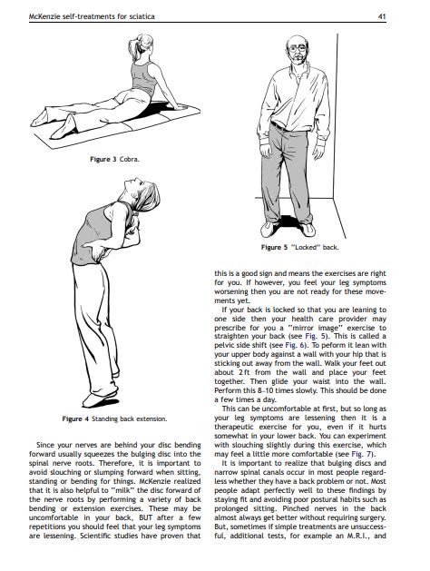 Mckenzie Low Back Excercise For Sciatica