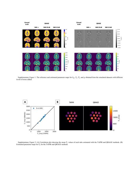 Pdf Qrage Simultaneous Multiparametric Quantitative Mri At Ultrahigh Field Strength