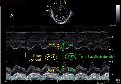 Echocardiography In General Practice 4 Views To Master Clinicians Br Medical Ultrasound