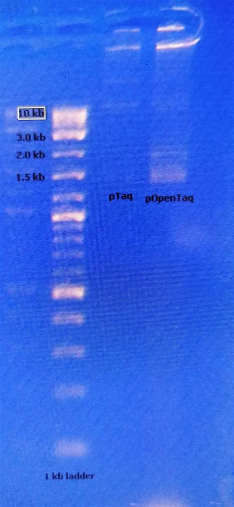 Troubleshooting In Alkaline Lysis Method Researchgate