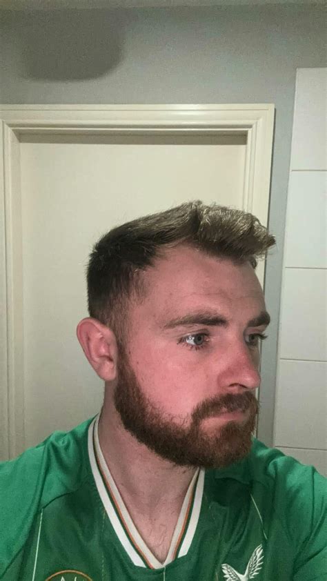 Solved Beard Dye Burns And Skin Rash From Beard Dye Bohemian Kings Eu