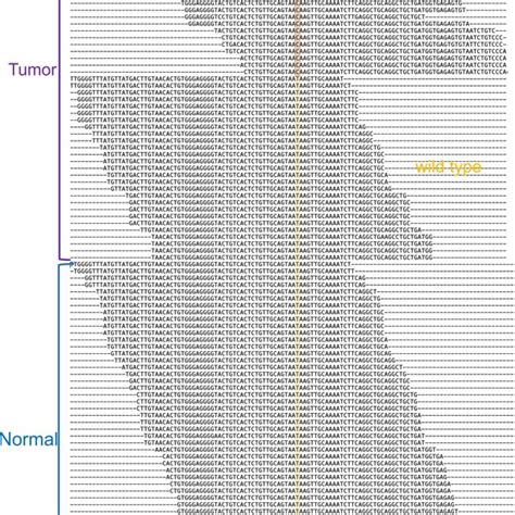 An Unmapped Somatic Variant From A Tcga Prad Patient Only Reads Download Scientific Diagram