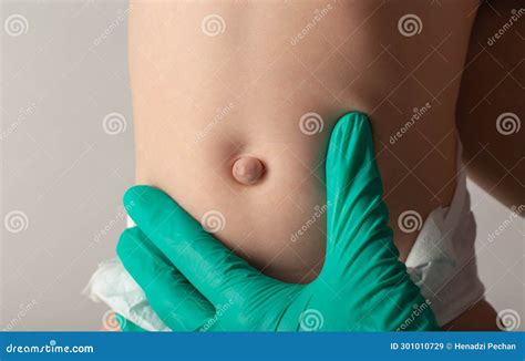 A Doctor Surgeon In Medical Gloves Examines The Abdomen Of A Newborn