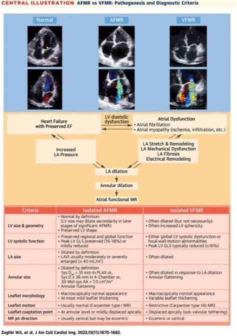 Atrial Functional Mr Vs Ventricular Functional Mr 🫀 Nadia Pinheiro