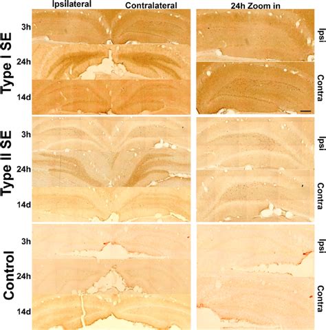 npy expression in dg photomicrograph of immunolabeling interneurons