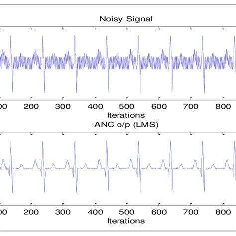 Complete Noise Free Ecg Signal And Ecg Signal Corrupted With Power Line Download Scientific