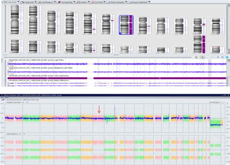 The Molecular‐cytogenetic Analyses Of The Proband By Affymetrix Download Scientific Diagram