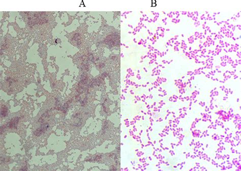 Seroprevalence And Molecular Characterization Of B Abortus Idr