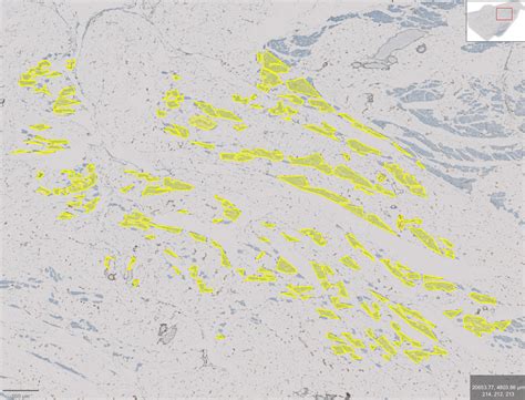 Qupath Script Command To Draw Polygon Annotation From Points Image Analysis Imagesc Forum