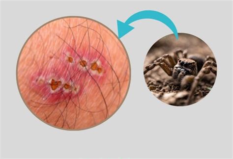 Wolf Spiders Size Habitat Bite Stages And Pictures