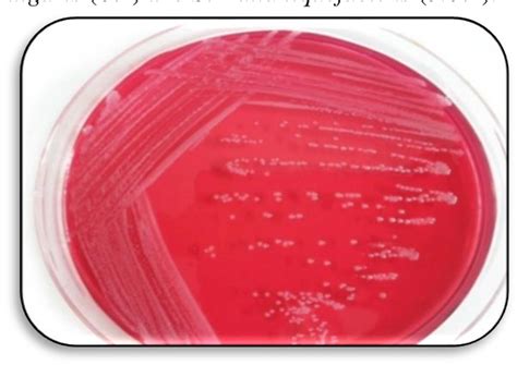 Figure 1 From Identification Of Acinetobacter Baumannii And