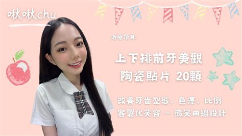 【尊榮貼片美齒計劃】jkf女郎啾啾吳慈敏笑容大升級👍🏻一口白皙陶瓷貼片💋笑容魅力融化人心😚 Youtube