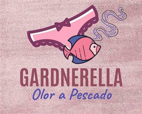 Dra María José Gutiérrez Hoy Hablaremos De Vaginosis Bacteriana No Es Considerada Una