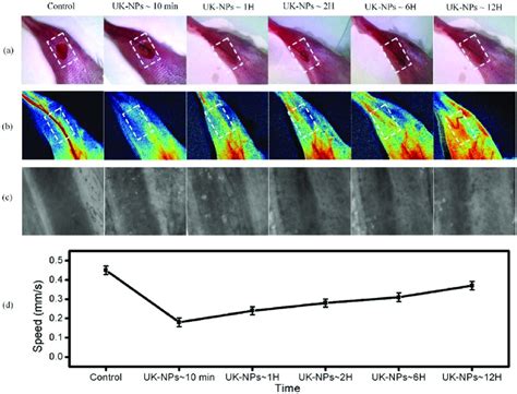 A Optical Photograph Of The Process Of Thrombolysis At 10 Min 1 H 2