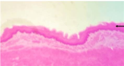 Aandp Lab Exam 3 Histology Flashcards Quizlet
