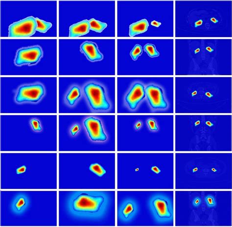 Sample Class Activation Map Of The Proposed Convolutional Neural Download Scientific Diagram