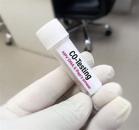 Vaginal Fluid Sample For CO Testing HPV DNA Test And Paps Smear Test Stock Image Image Of