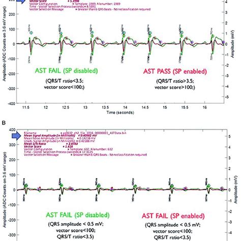 Different Automated Screening Tool Outcomes Depending On If Signal Was Different Automated Screening Tool Outcomes Depending On If Signal Was
