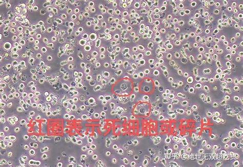 如何鉴别活细胞和死细胞 知乎