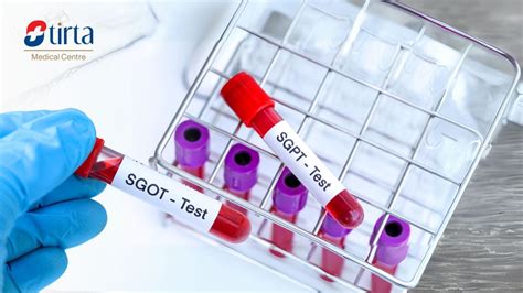 What Are Sgot And Sgpt Causes Of High Test Results