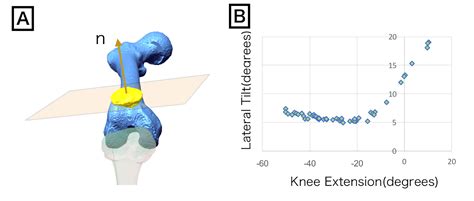 Four Dimensional Ct Analysis Using Sequential 3d 3d Registration