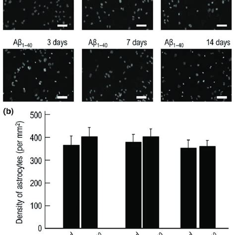 Quantification Of Synapse Number Using Puncta Analyzer Shown Here Is
