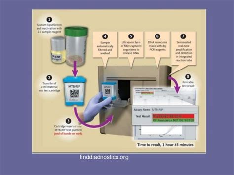 Diagnostics Of Tuberculosis An Insight Into Genexpert 27 4 15