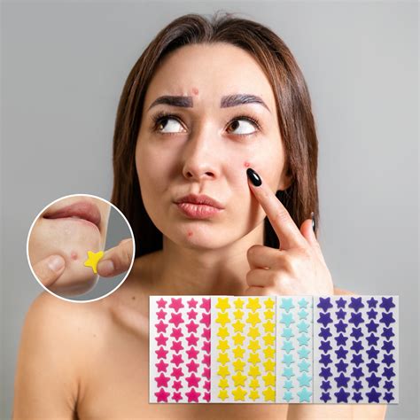 Staoedu Acne Patch Pimple Patch 4 Colors 160 Dots Star Pimple Patches With Tea Tree Oil