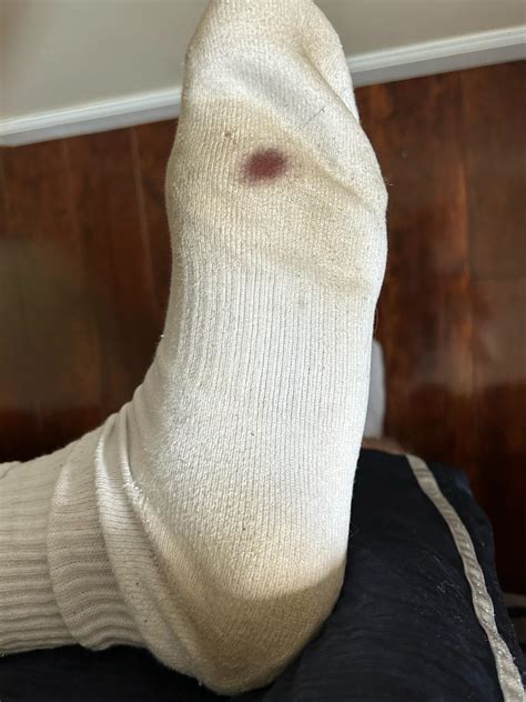 They Dont Learn 1 By Giantlongsocks On Deviantart