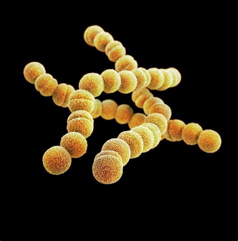 Streptococcus Pyogenes Bacteria 1 Photograph By Science Photo Library Pixels Merch