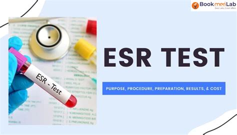 Esr Test Price Normal Range Procedure Risk Results [2025]