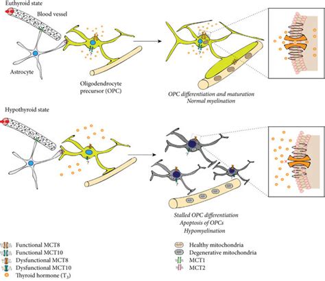 Hypothyroid State Within The Cns Leads To Cellular Hypothyroidism In