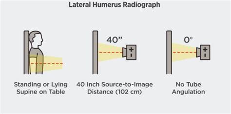 Optimal Lateral Humerus X Rays Positioning The Radiographer S Guide HSIN FILM