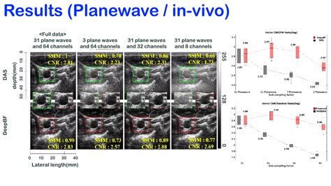 Universal Plane Wave Compounding For High Quality Us Imaging Using Deep Learning Ppt Free