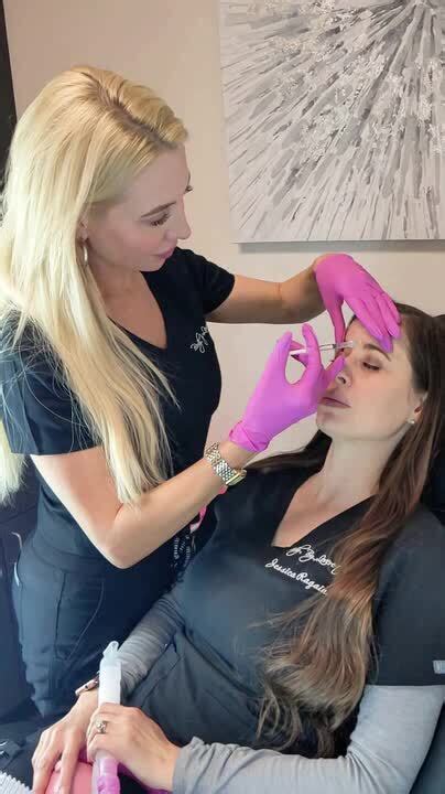 Botox Treatment Video RealSelf