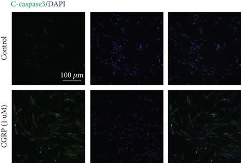 Cgrp Repressed Cell Proliferation And Triggered Cell Apoptosis In